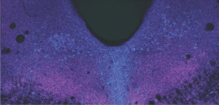 How does fear develop in the brain? | TecScience