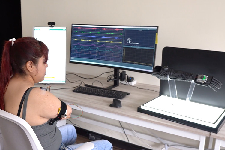 The Era of Smart Prosthetics has Arrived | TecScience